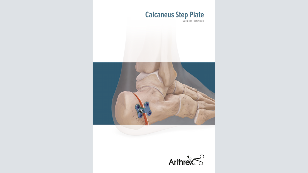 Arthrex - Calcaneus Step Plate