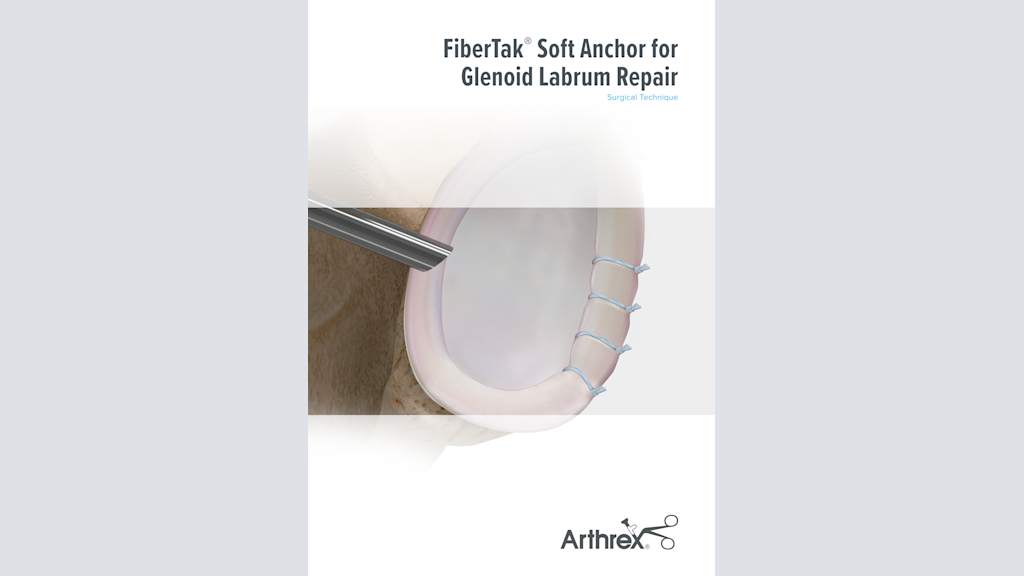 Arthrex - FiberTak® Soft Anchor