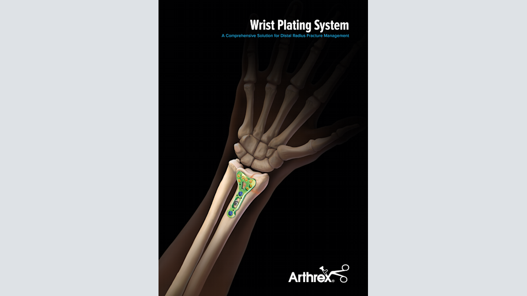 Arthrex - Titanium Wrist Plating System