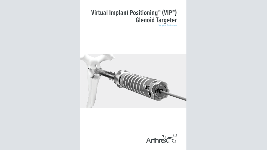 Arthrex - Sistema Virtual Implant Positioning™ (VIP™)