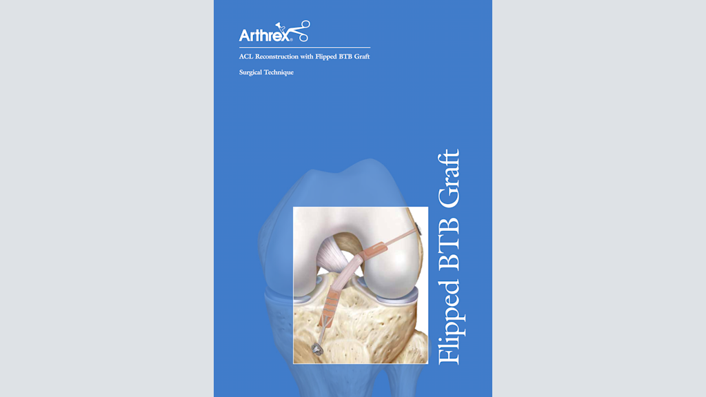 Arthrex - BTB Autograft ACL Reconstruction