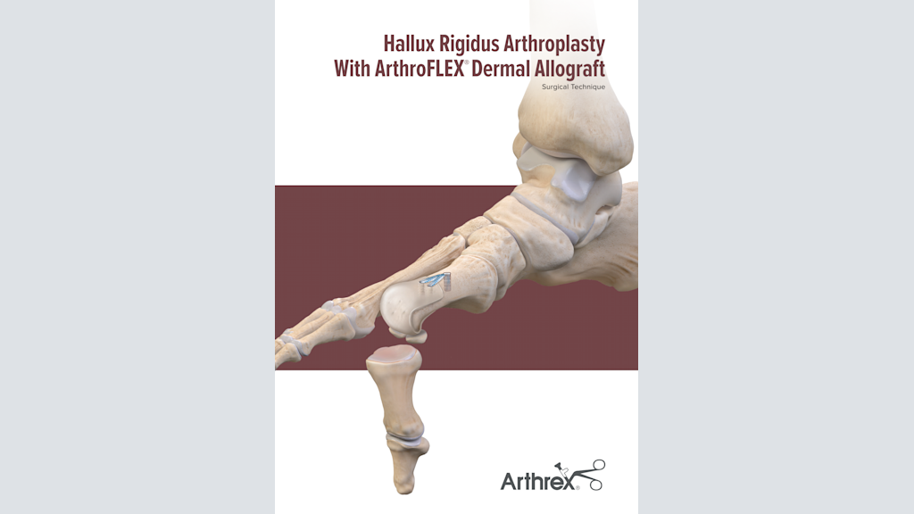 Arthrex - ArthroFLEX® zellfreies dermales Allograft