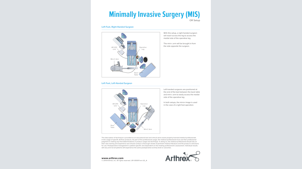 Arthrex - Minimally Invasive Surgery
