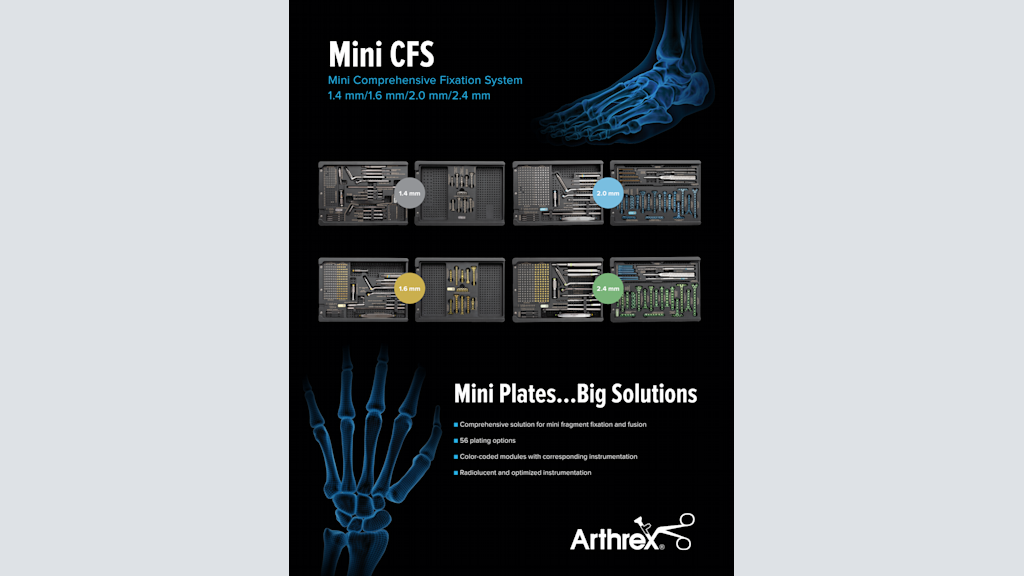 Arthrex - Placas para fijación de mini-fragmentos