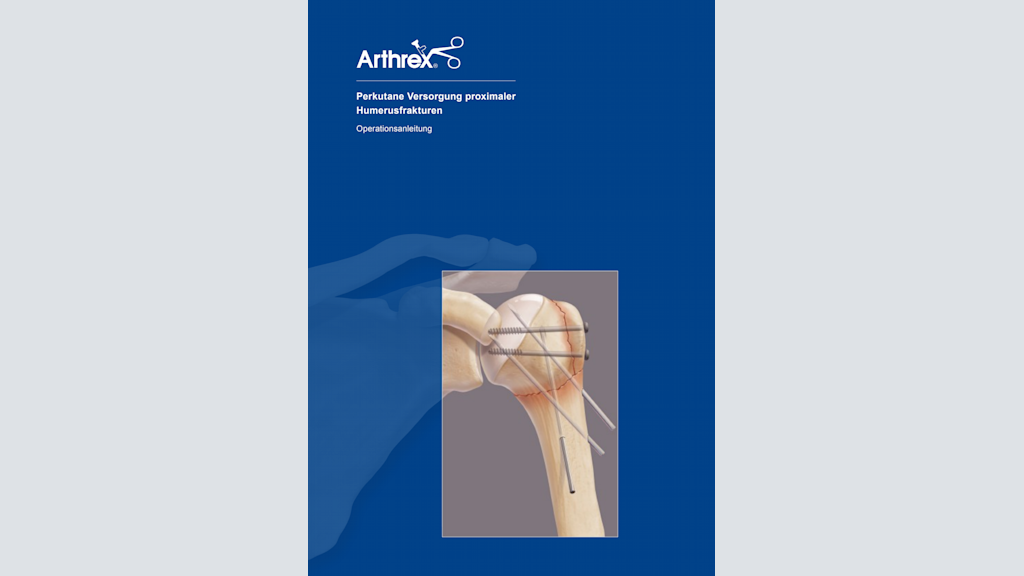 Arthrex - Percutaneous Pinning Technique