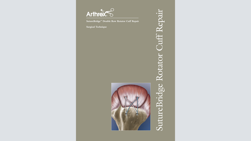 Arthrex - SutureBridge™ Double Row Technique