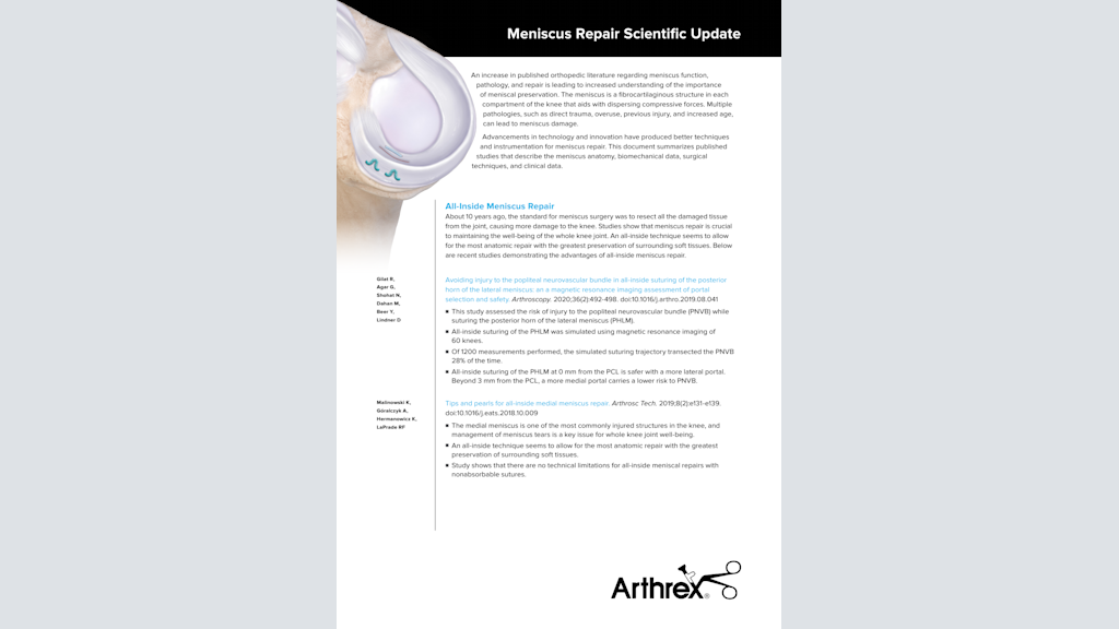 Arthrex - Meniscal Cinch™ II Technique