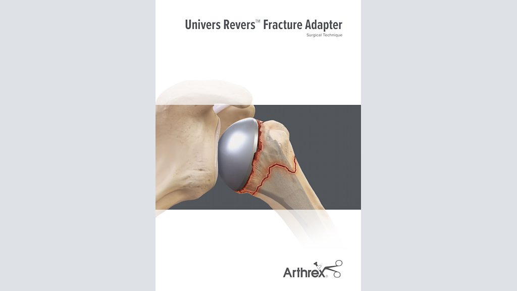 Arthrex - Univers Revers™ Total Shoulder System