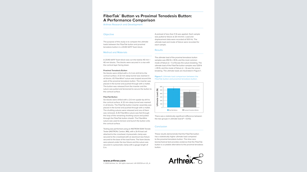 Arthrex - Cortical Button Tenodesis Technique