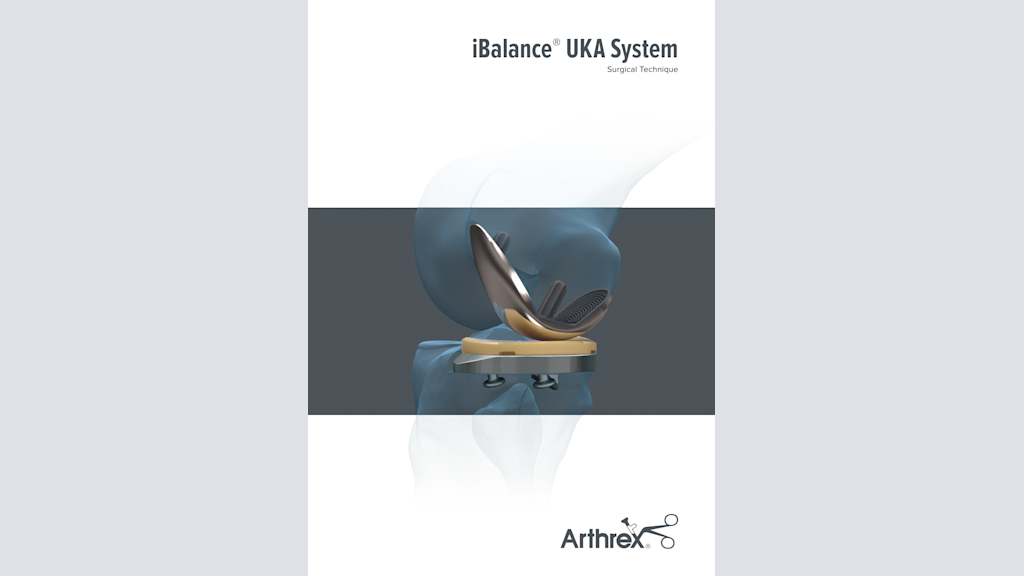 Arthrex - iBalance® UKA System