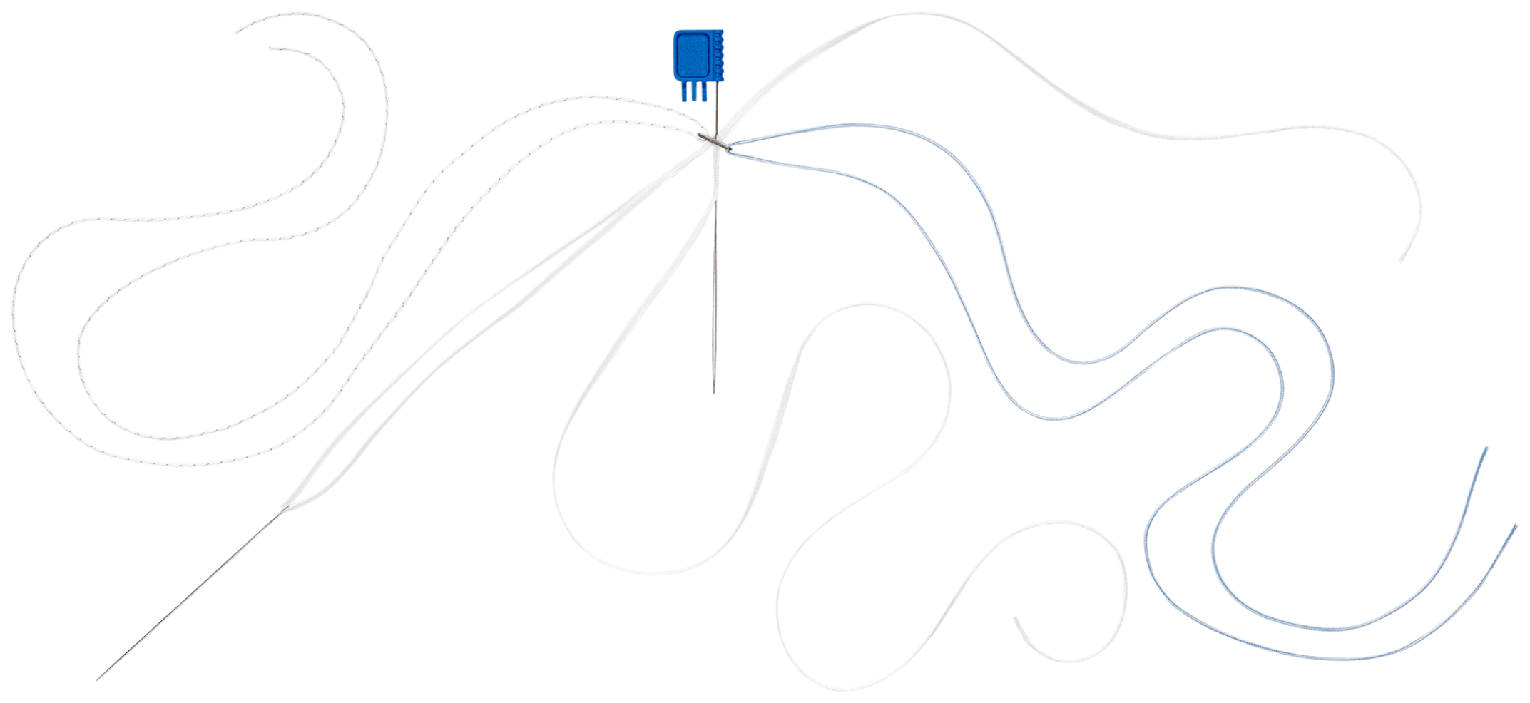 Arthrex - TightRope II BTB, with Additional Flipping Suture - AR-1588BTB-2J