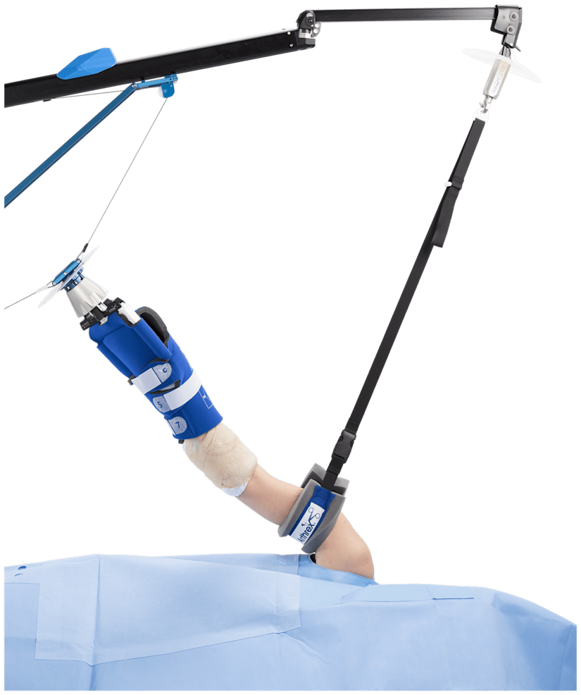 Arthrex - Shoulder Suspension System (S3) (Includes: Tower, US Clark ...