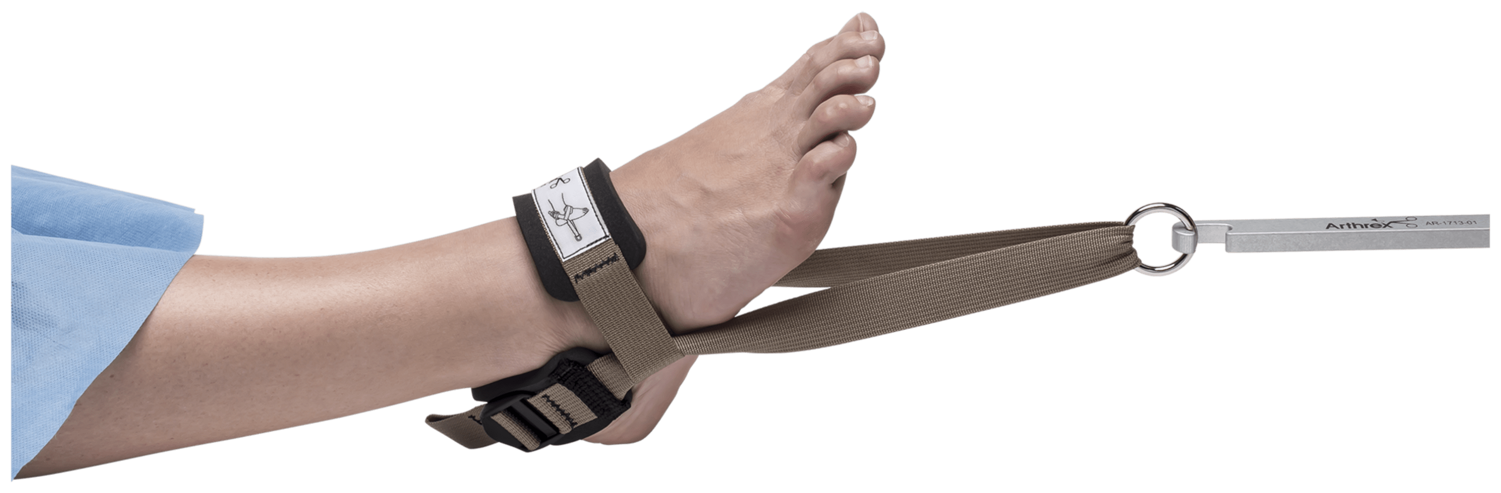 Arthrex - Ankle Arthroscopy Distractor Strap, sterile, qty. 5, SU - AR-1712