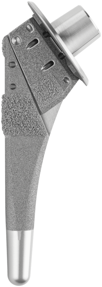 Arthrex - Univers Apex OptiFit Humeral Stem, 7mm - AR-9100-07M