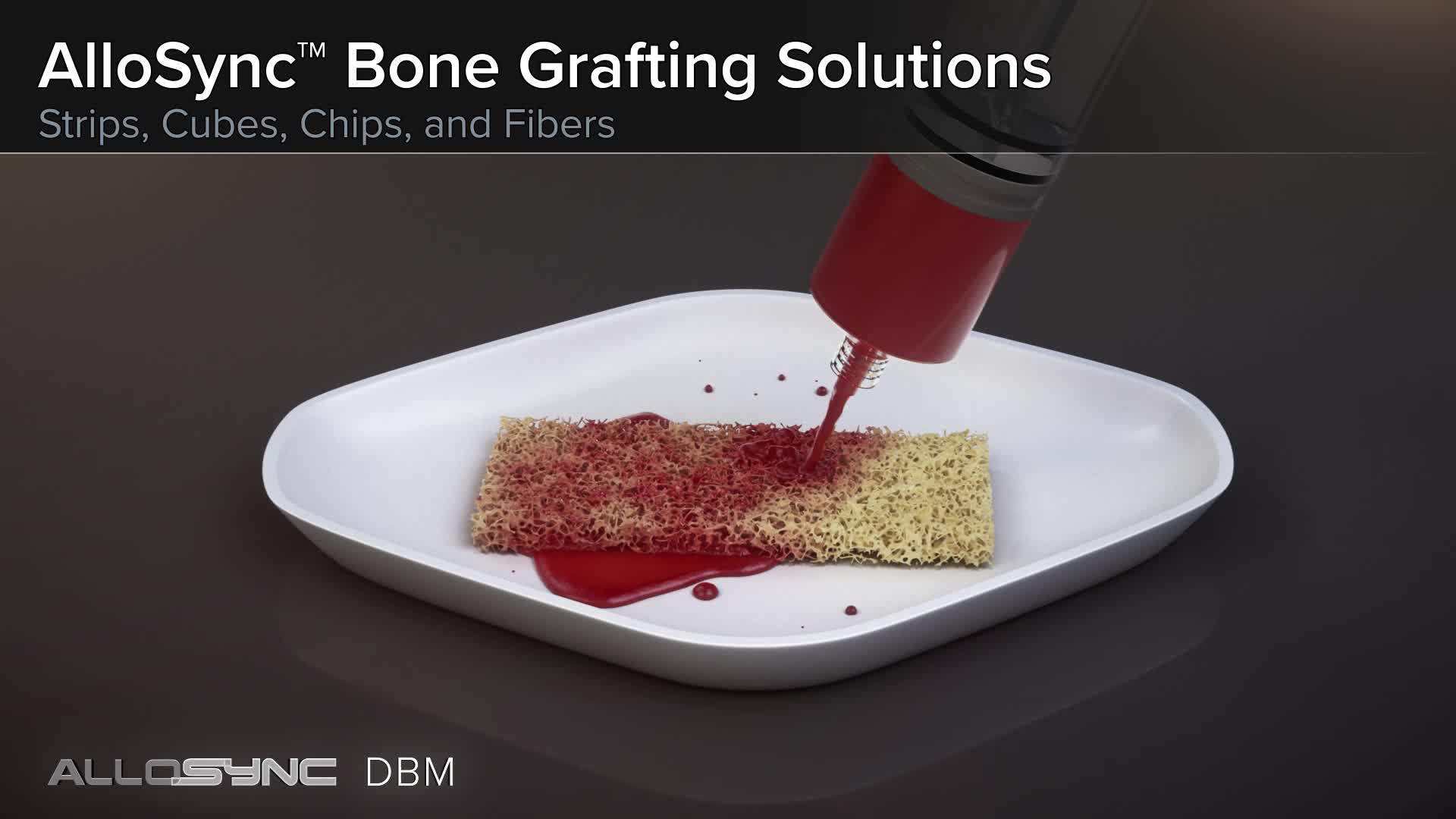 Arthrex - AlloSync™ Bone Grafting Solutions for Spine Procedures