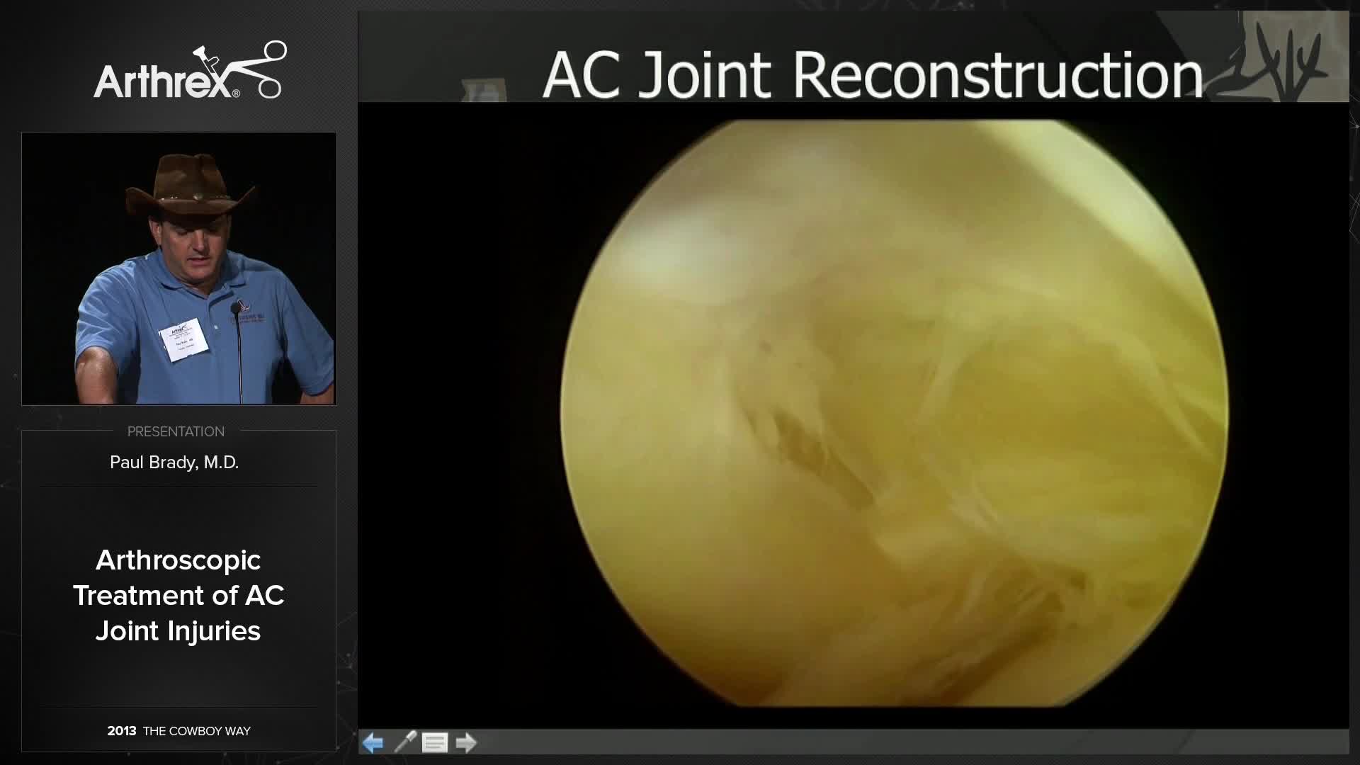 Arthrex - Arthroscopic Treatment of AC Joint Injuries – Cowboy Way 2013