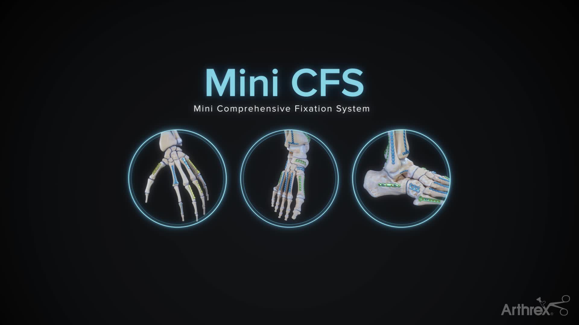 Arthrex - Mini CFS Plates - Foot and Ankle