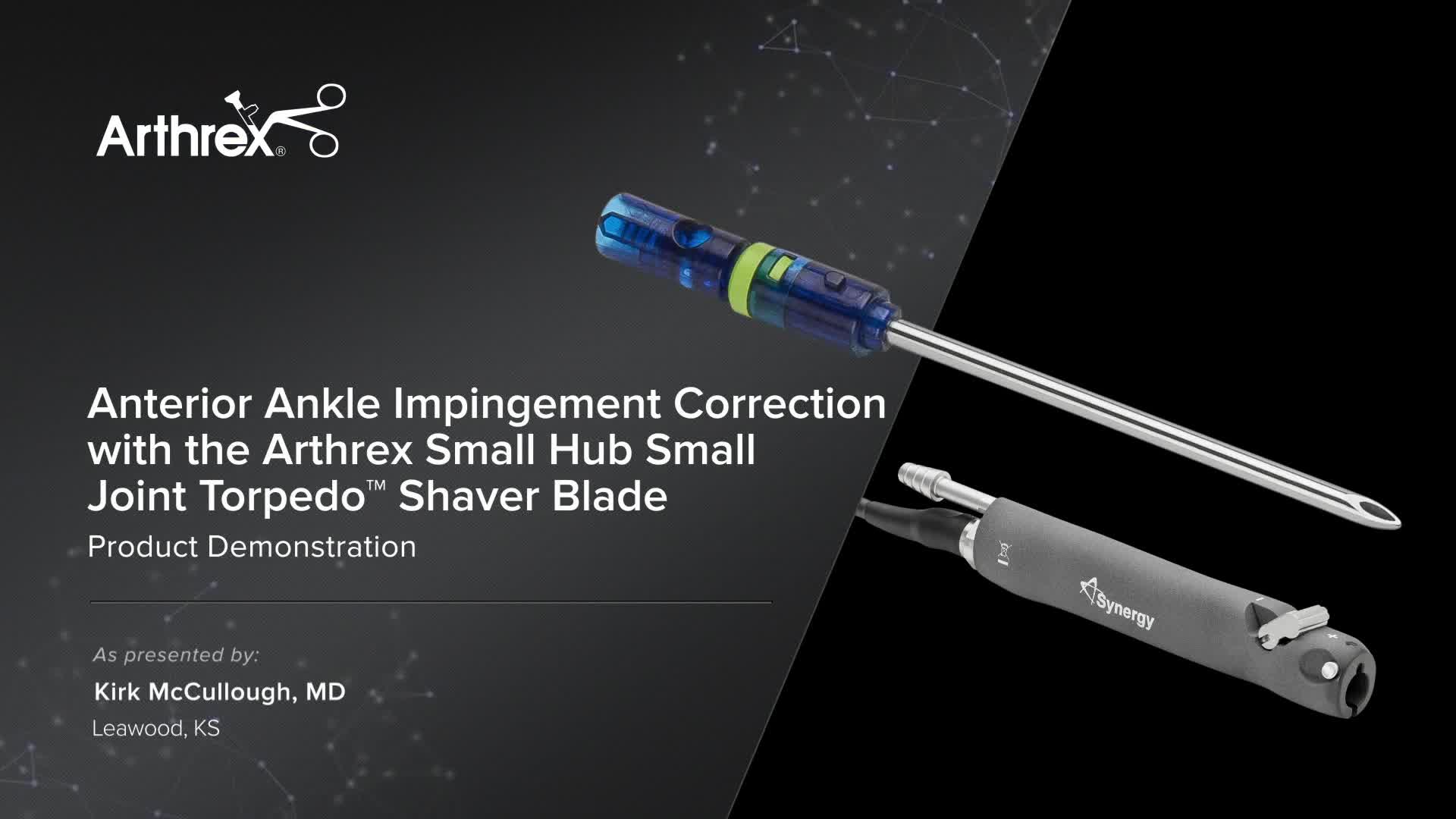 Arthrex - Anterior Ankle Impingement Correction with the Arthrex Small ...