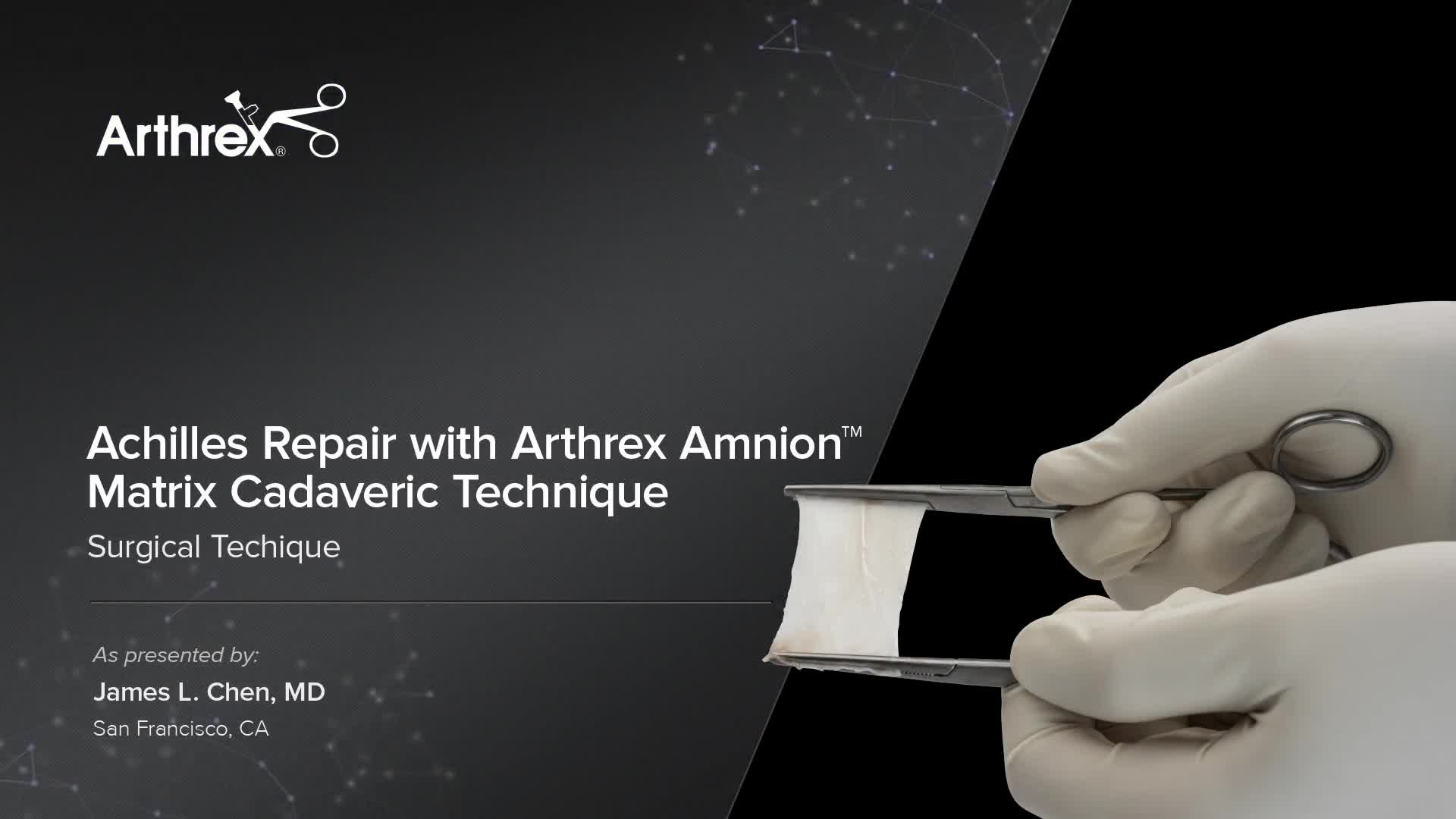 Arthrex - Achilles Repair with Arthrex Amnion™ Matrix Cadaveric Technique