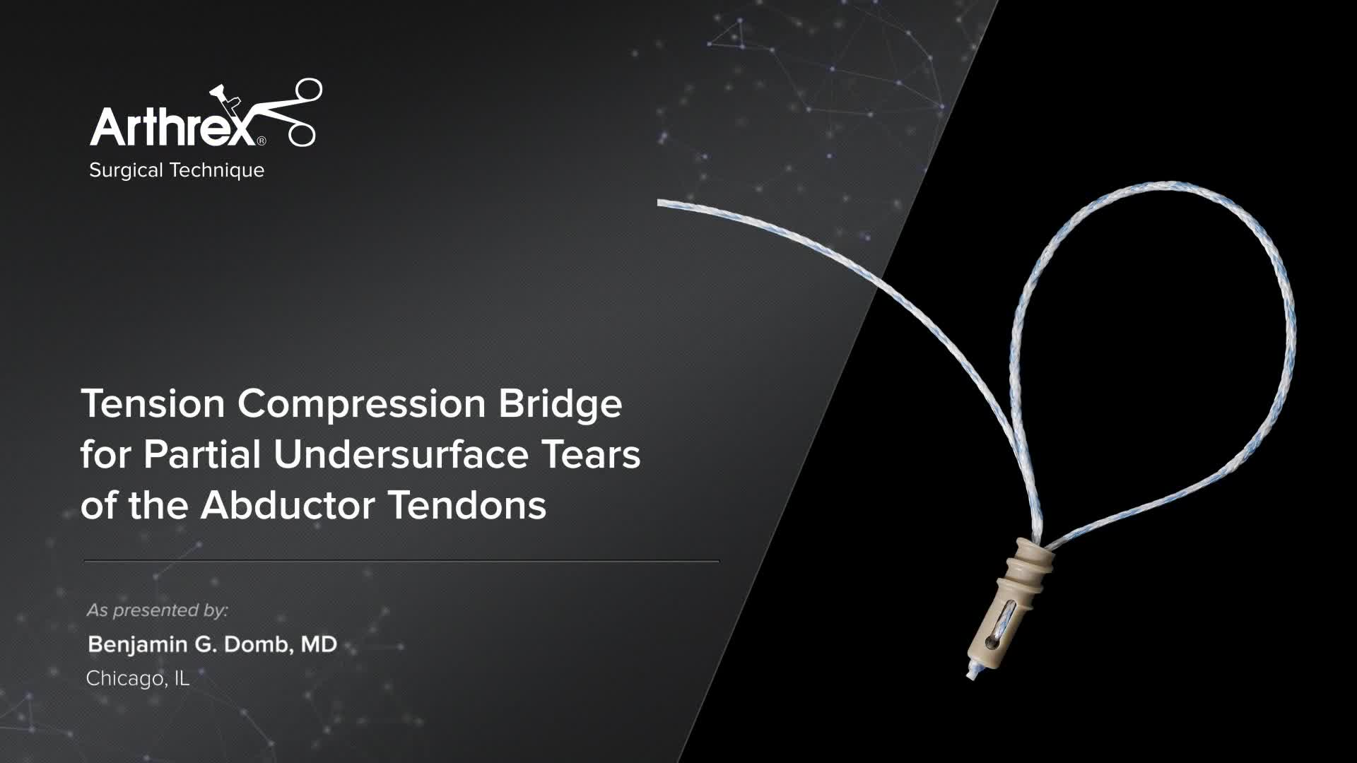 Arthrex - Tension Compression Bridge for Partial Undersurface Tears of ...