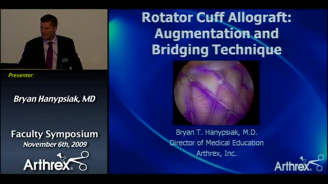 Arthrex - Rotator Cuff Allograft: Augmentation and Bridging Technique