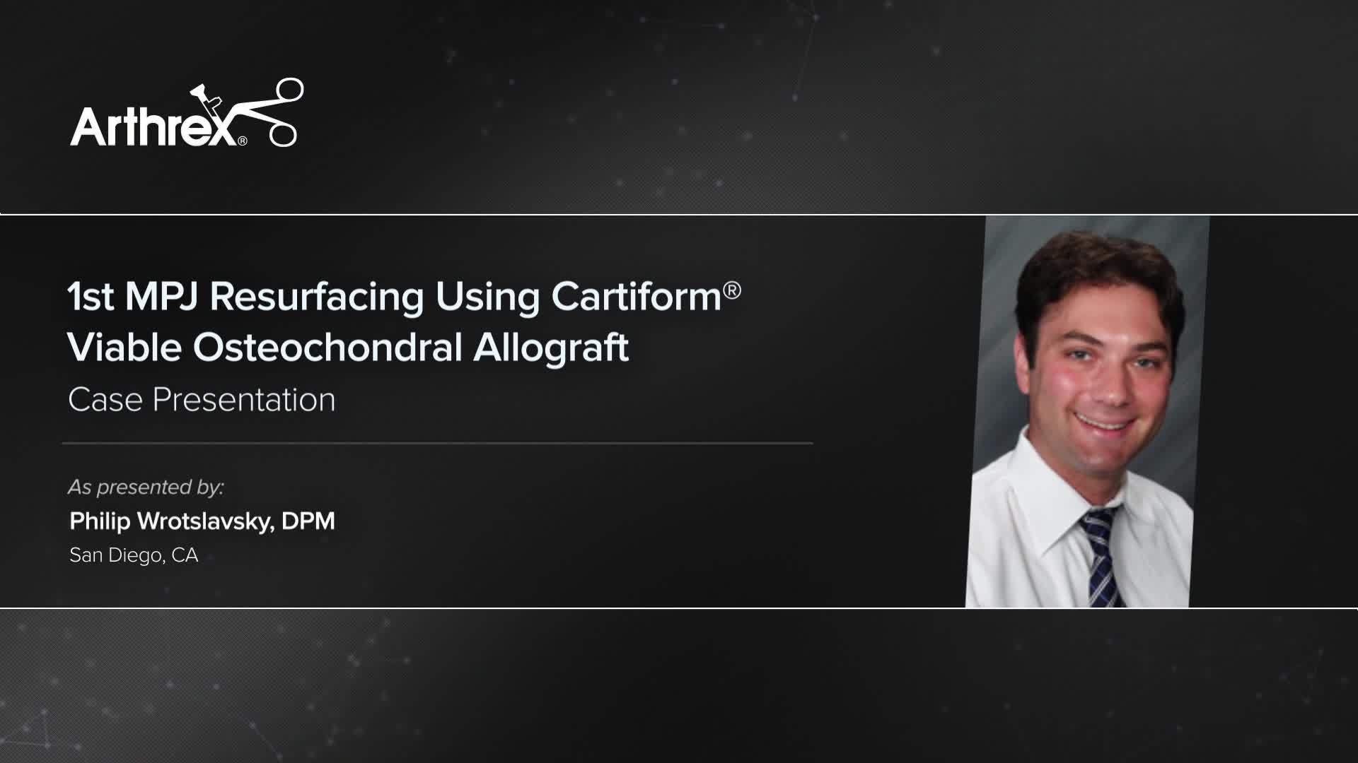 Arthrex - 1st MPJ Resurfacing Using Cartiform® Viable Osteochondral ...