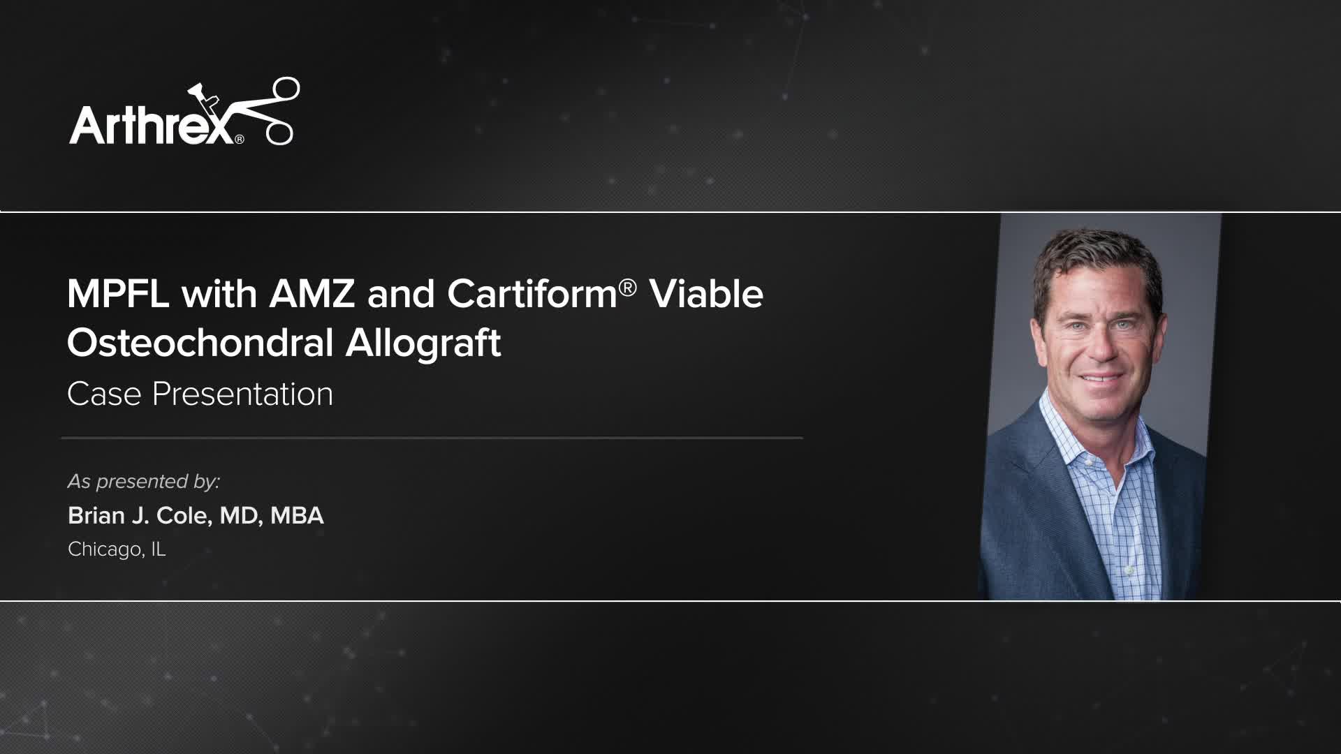 Arthrex - MPFL with AMZ and Cartiform® Viable Osteochondral Allograft