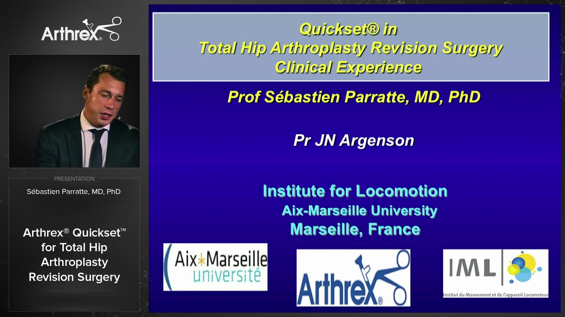 Arthrex - Arthrex® Quickset™ for Total Hip Arthroplasty Revision Surgery