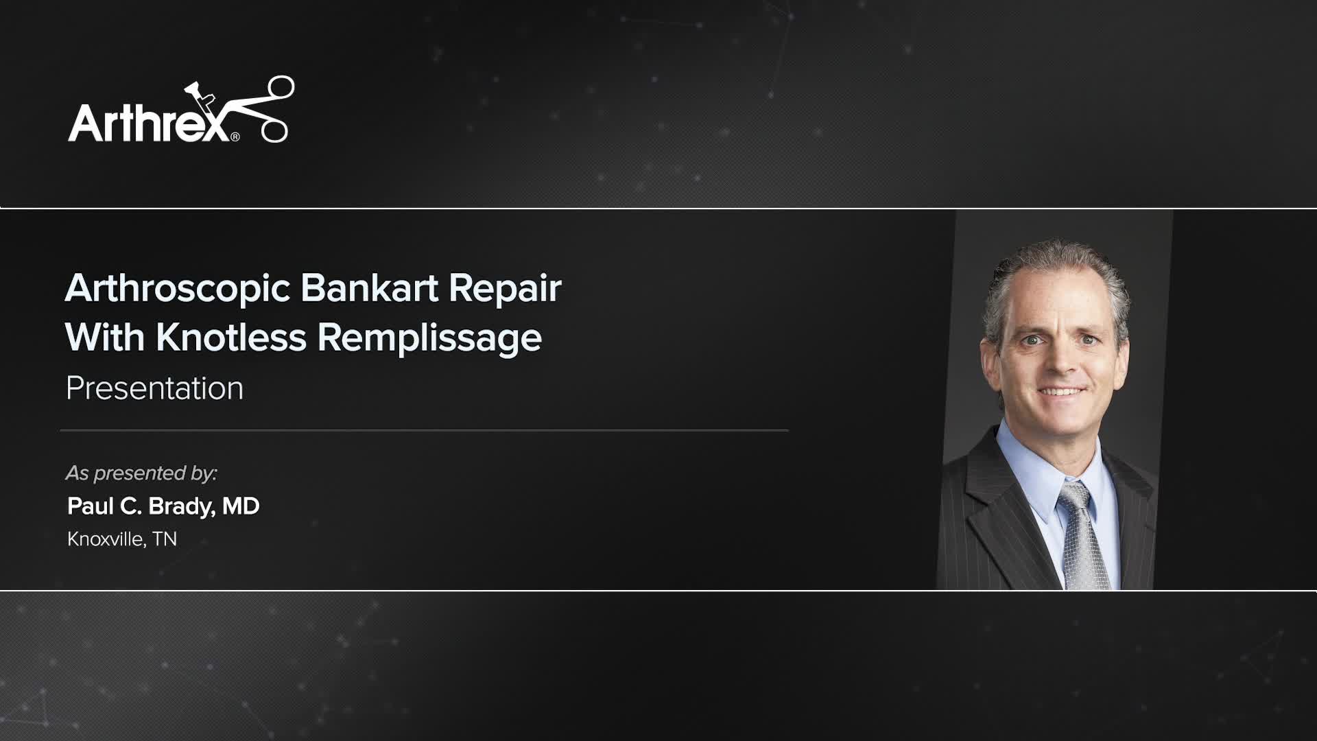 Arthrex - Arthroscopic Bankart Repair With Knotless Remplissage