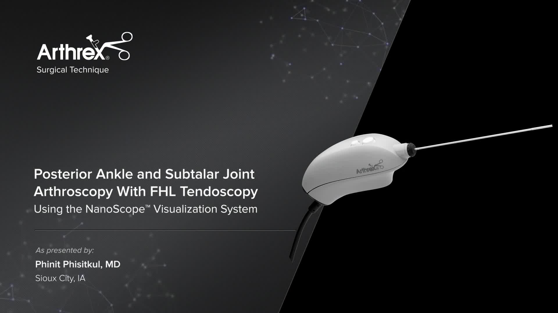 Arthrex - Posterior Ankle and Subtalar Joint Arthroscopy With FHL ...