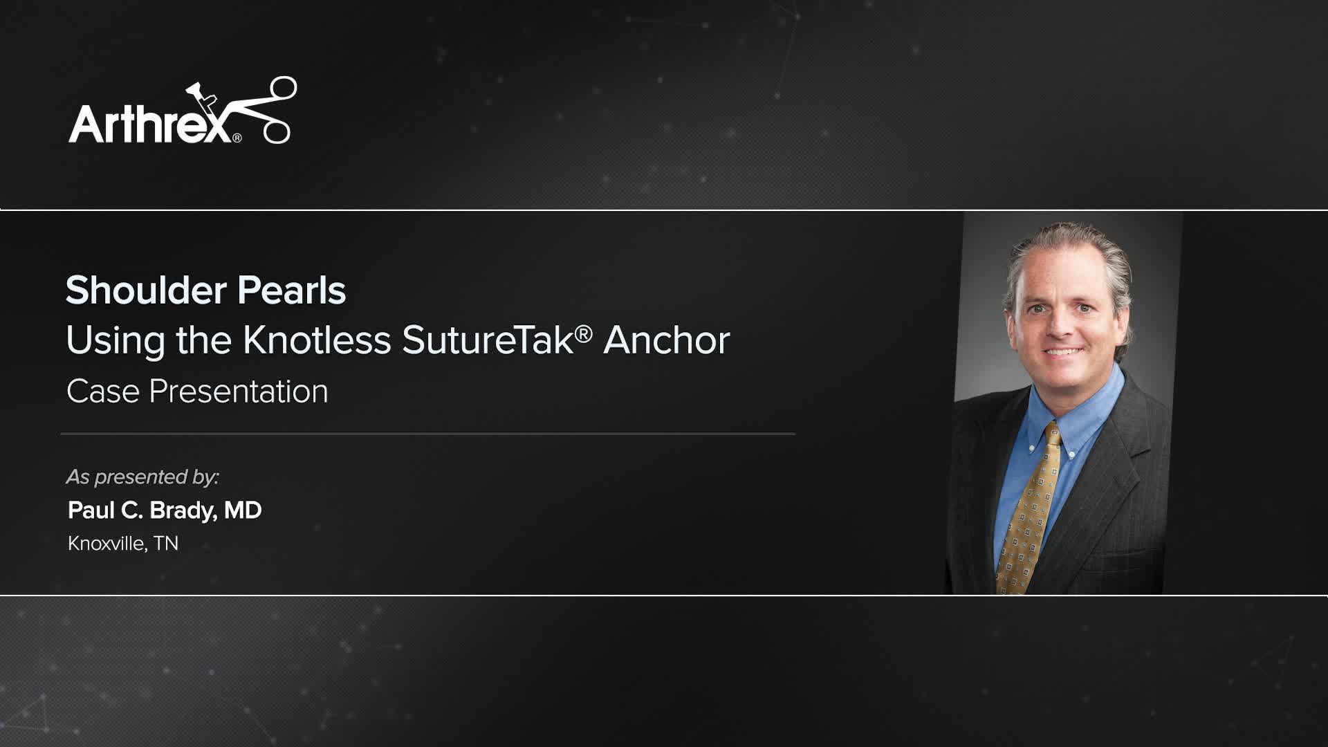 Arthrex - Shoulder Pearls Using the Knotless SutureTak® Anchor