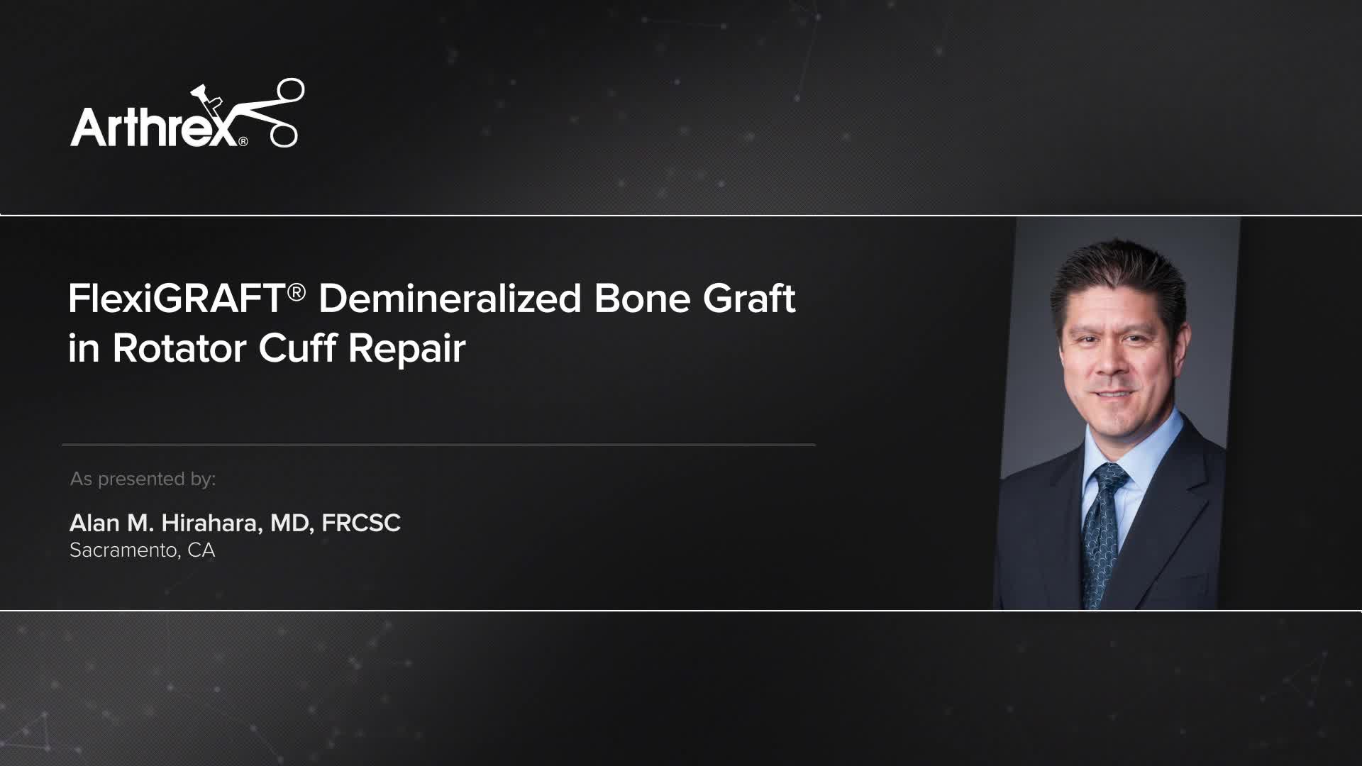 Arthrex - FlexiGRAFT® Demineralized Bone Graft in Rotator Cuff Repair