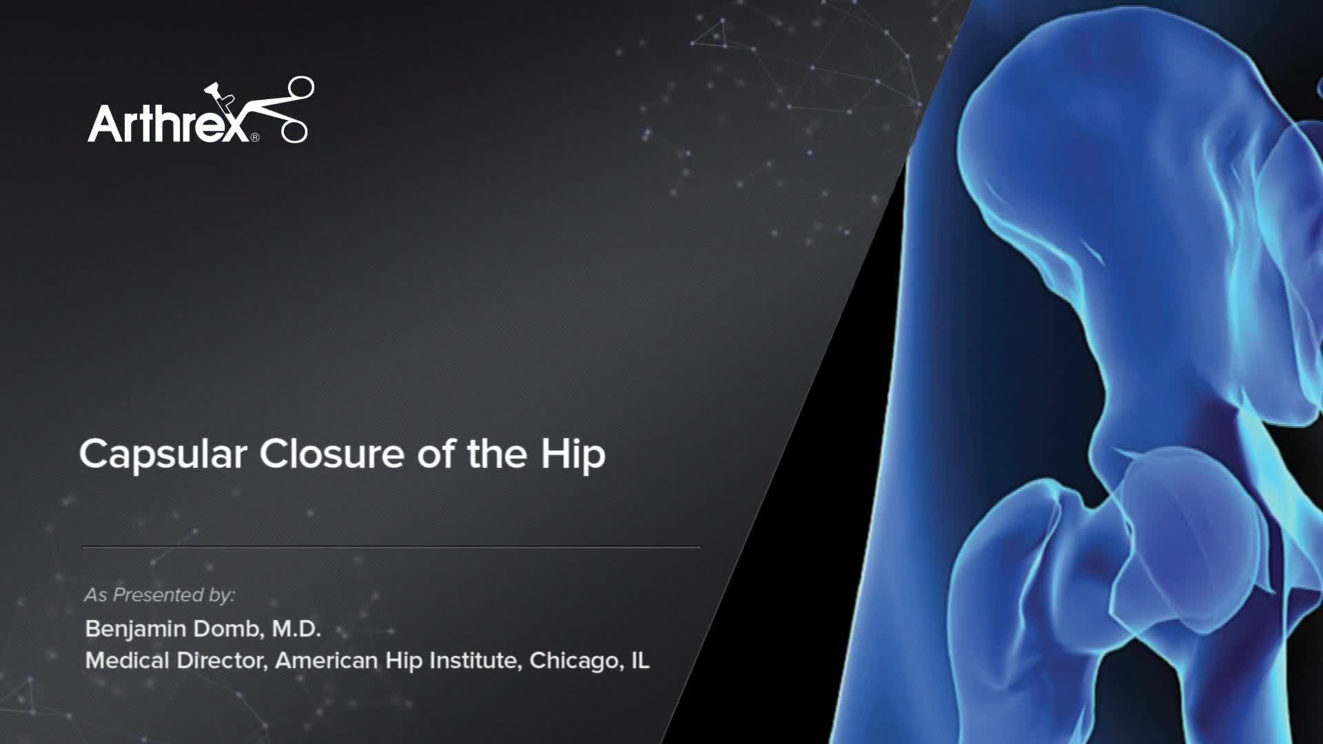 Arthrex - Capsular Closure of the Hip Surgical Technique