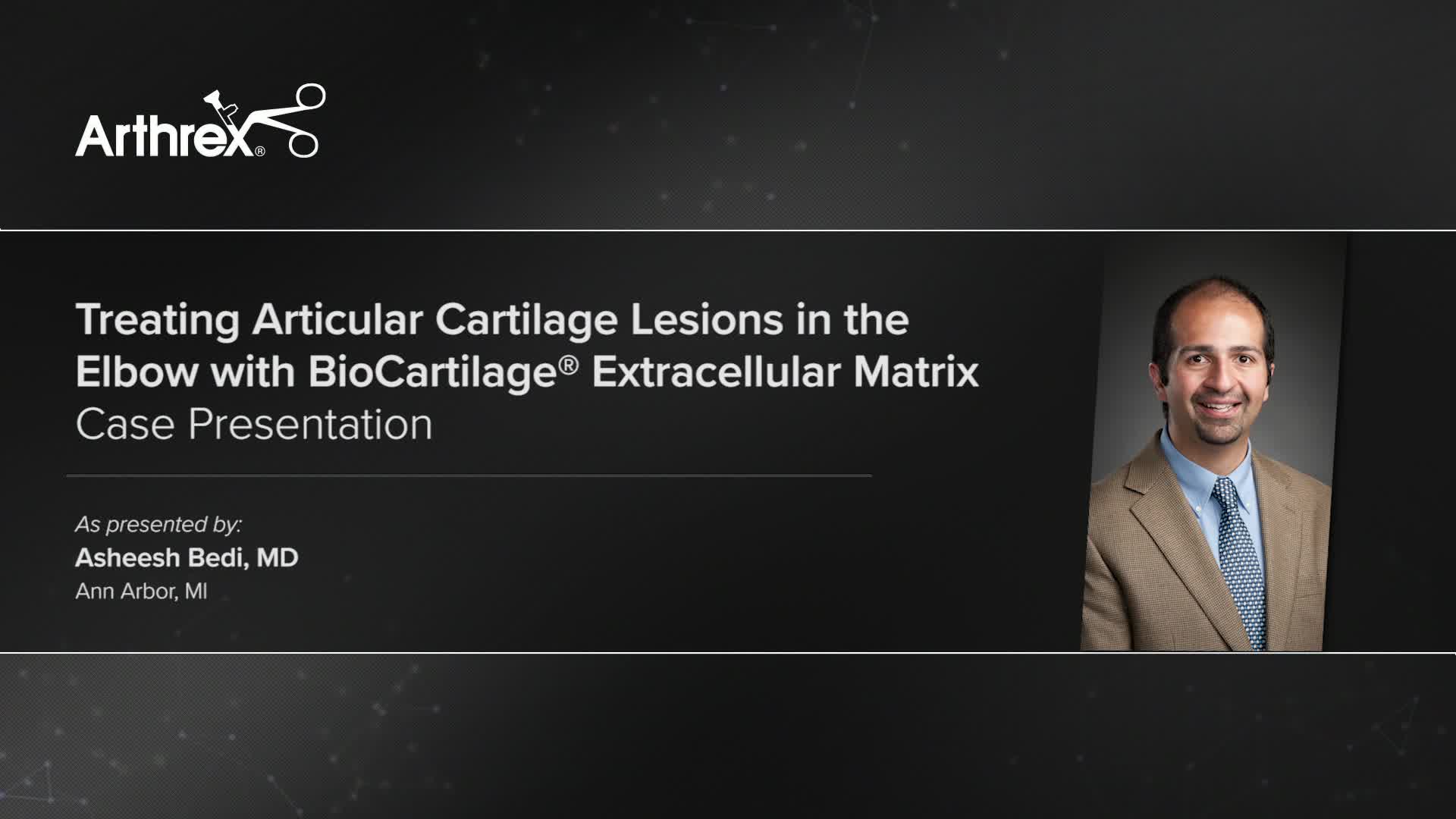 Arthrex - Treating Articular Cartilage Lesions in the Elbow with ...