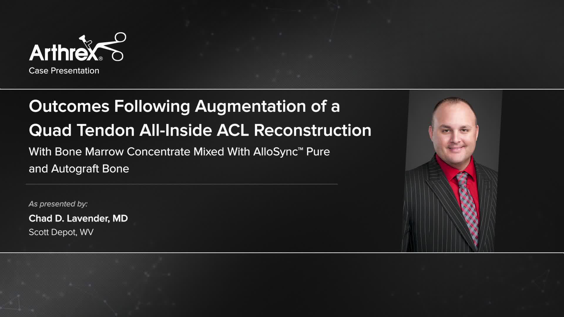 Arthrex - Outcomes Following Augmentation of a Quad Tendon All-Inside ...