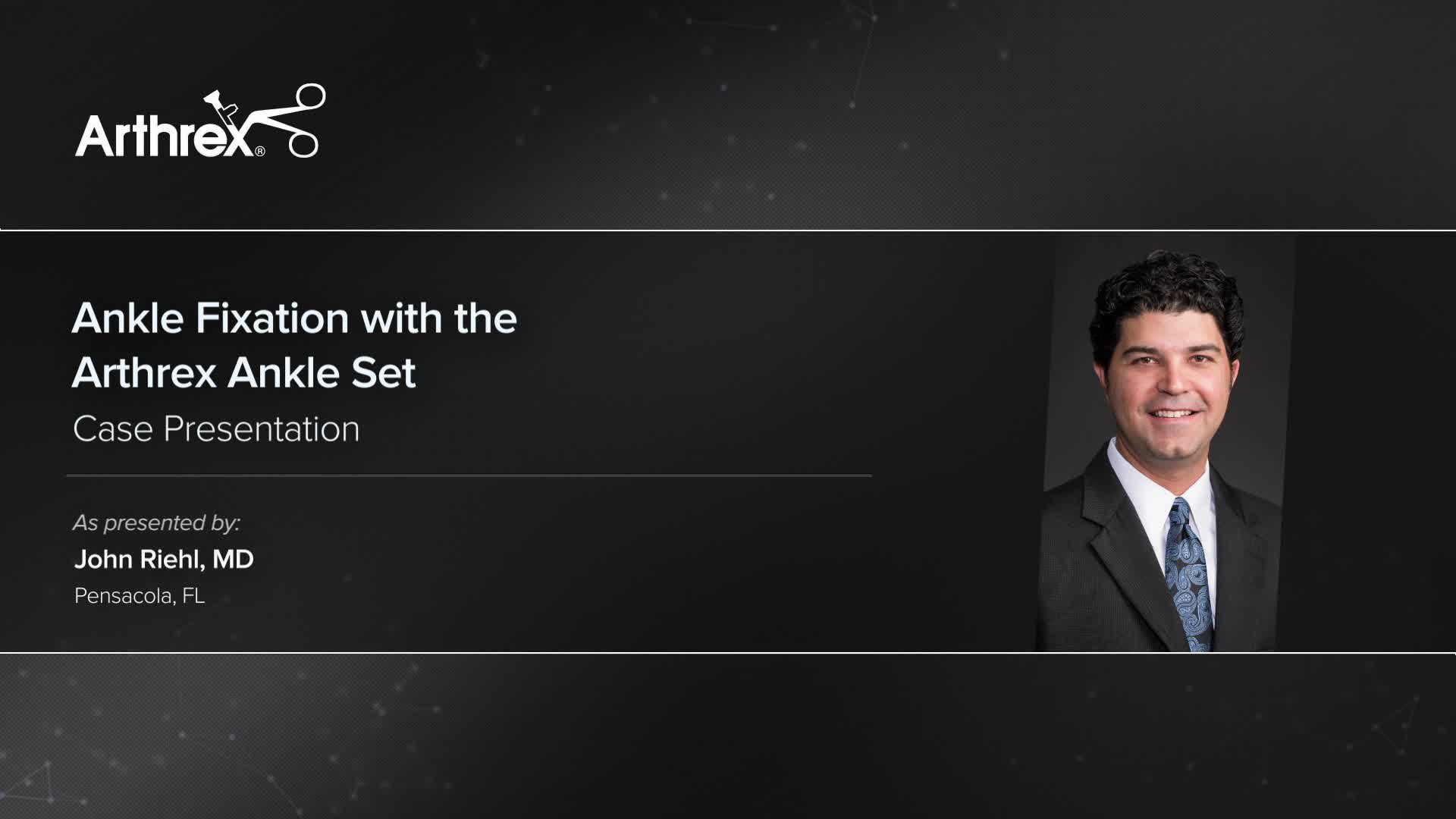 Arthrex - Ankle Fixation with the Arthrex Ankle Set