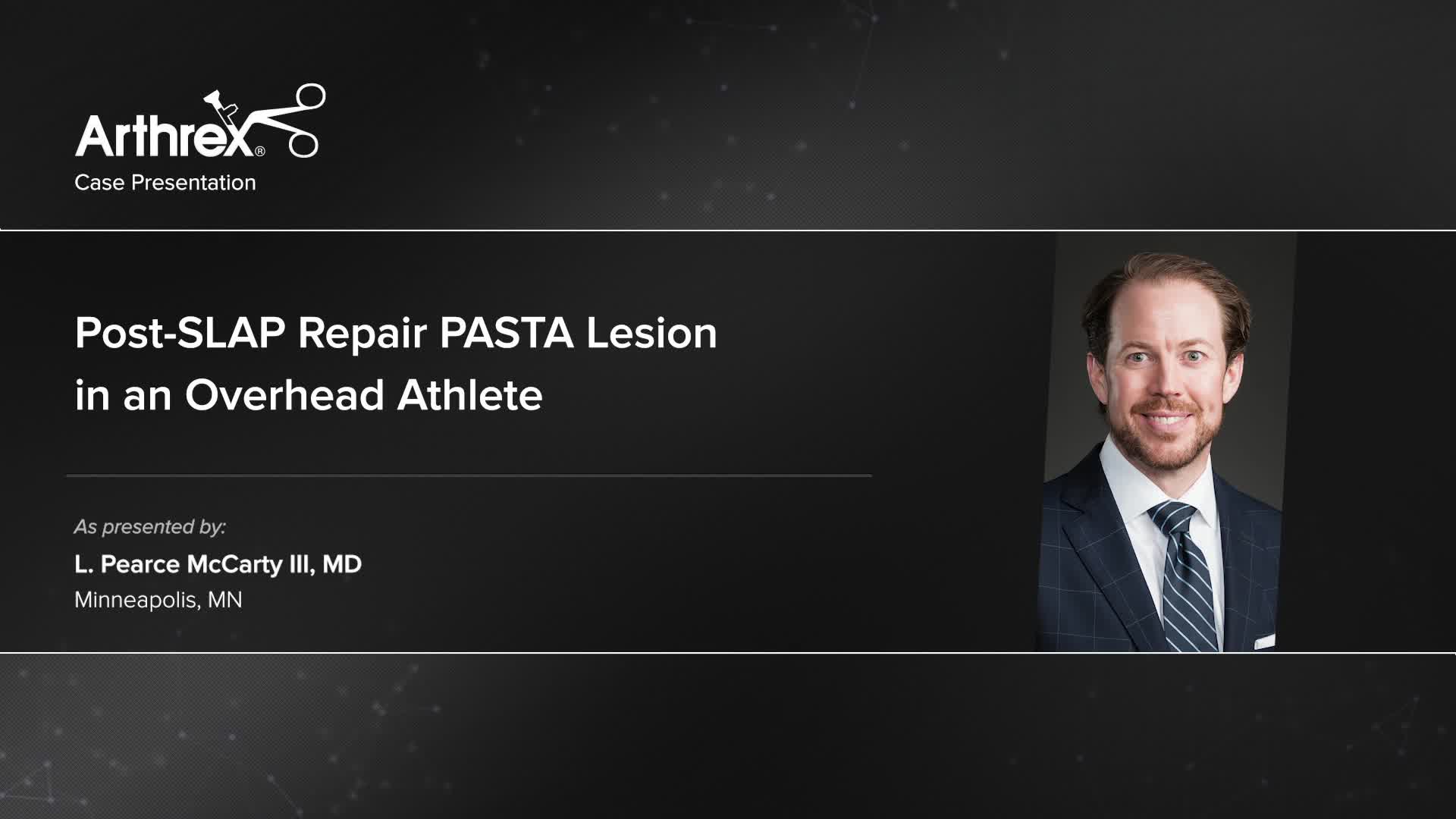 Arthrex - Post-SLAP Repair PASTA Lesion in an Overhead Athlete