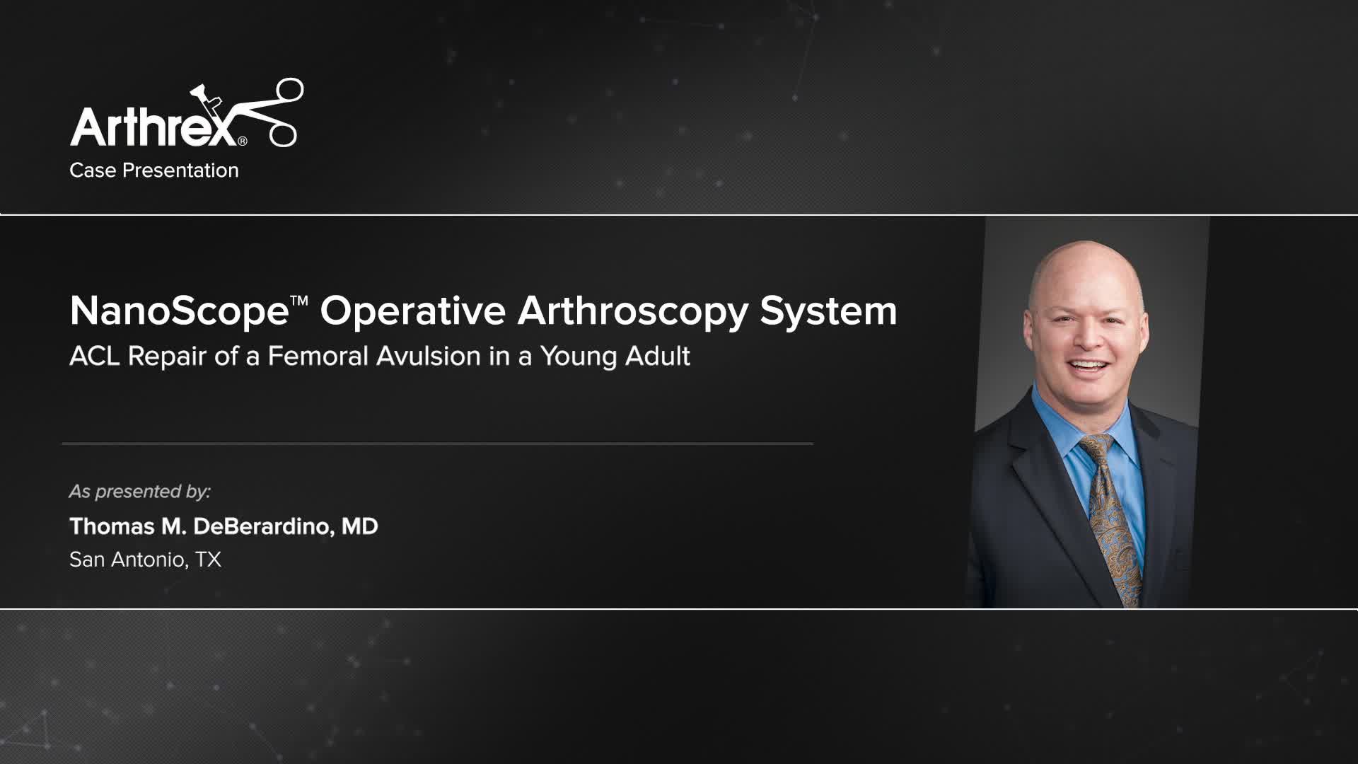 Arthrex - NanoScope™ Operative Arthroscopy System - ACL Repair of a ...