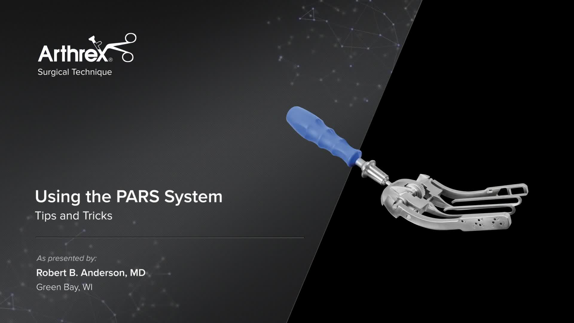 Arthrex - Using the PARS System Tips and Tricks