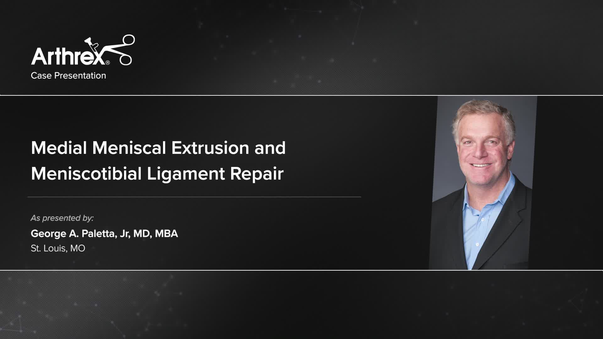 Arthrex - Medial Meniscal Extrusion and Meniscotibial Ligament Repair