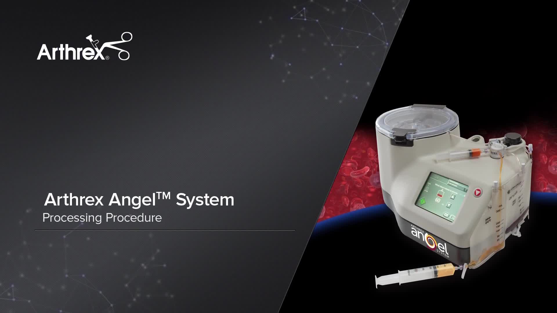 Arthrex - Arthrex Angel™ System Processing Procedure Demonstration