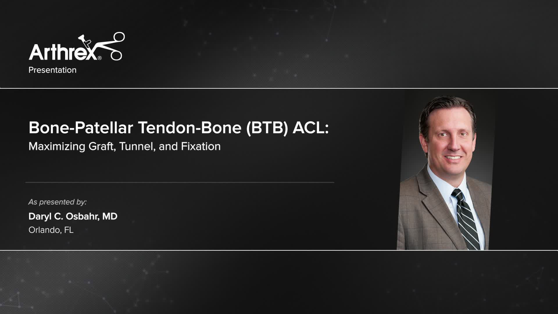 Arthrex - Bone-Patellar Tendon-Bone (BTB) ACL: Maximizing Graft, Tunnel ...