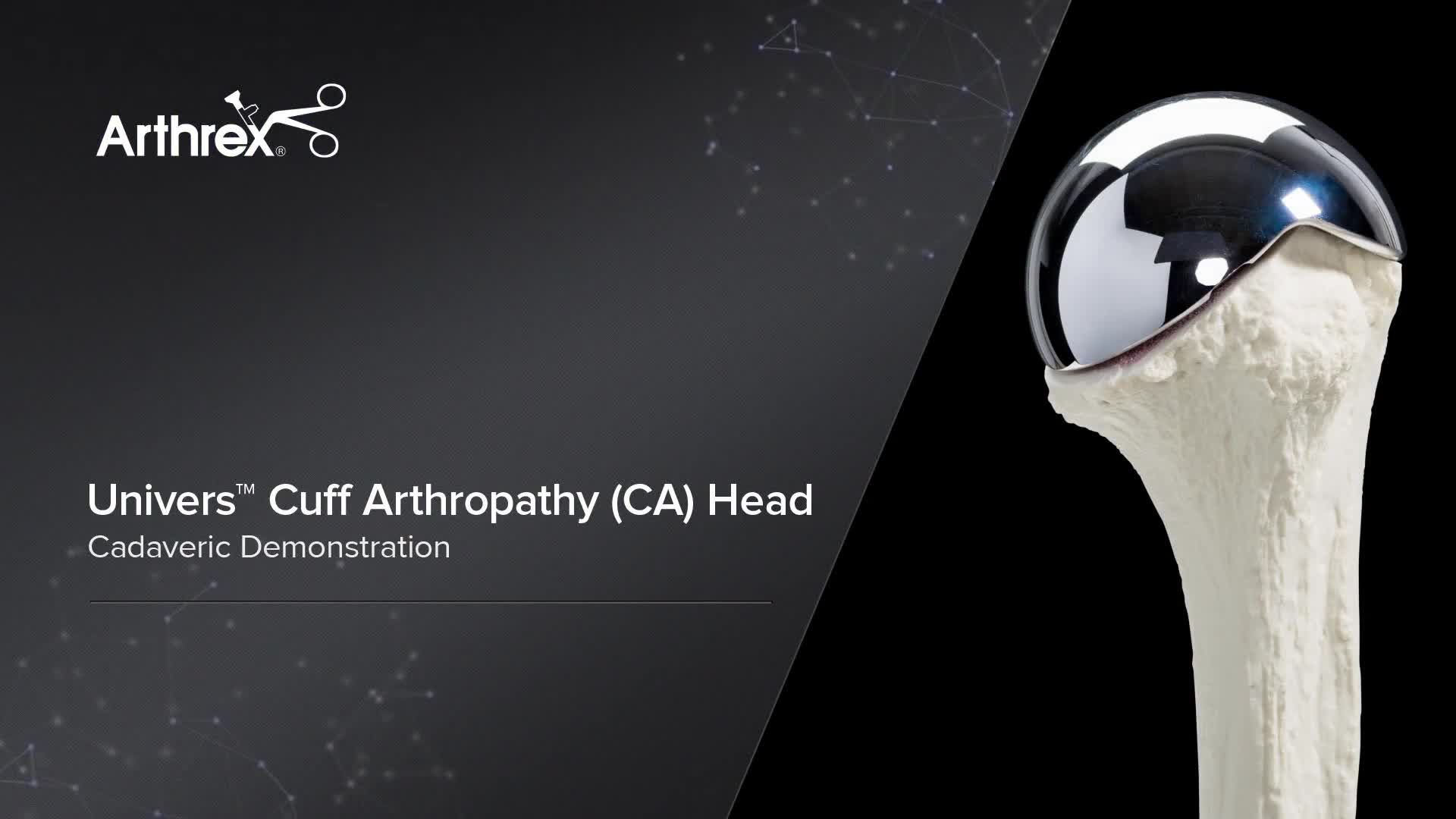 Arthrex - Univers™ Cuff Arthropathy (CA) Head Cadaveric Demo