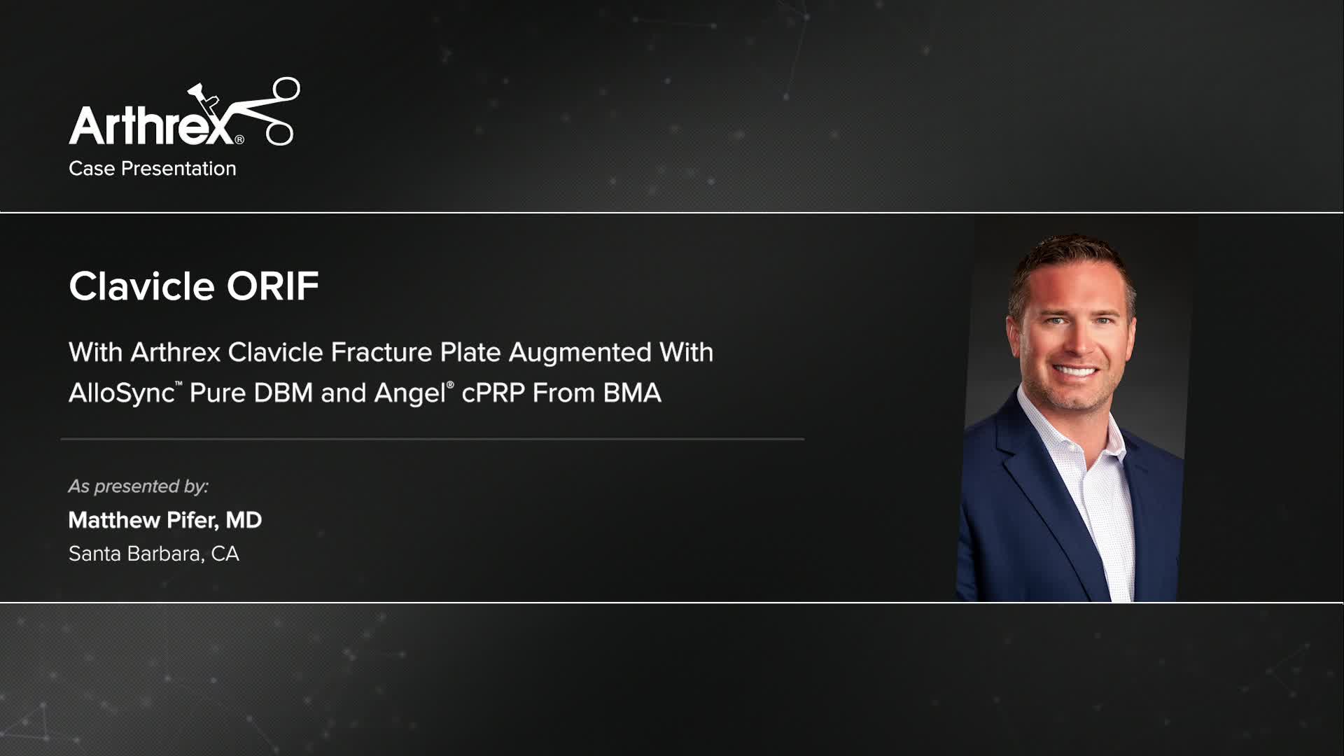 Arthrex - Clavicle ORIF With Arthrex Clavicle Fracture Plate Augmented ...