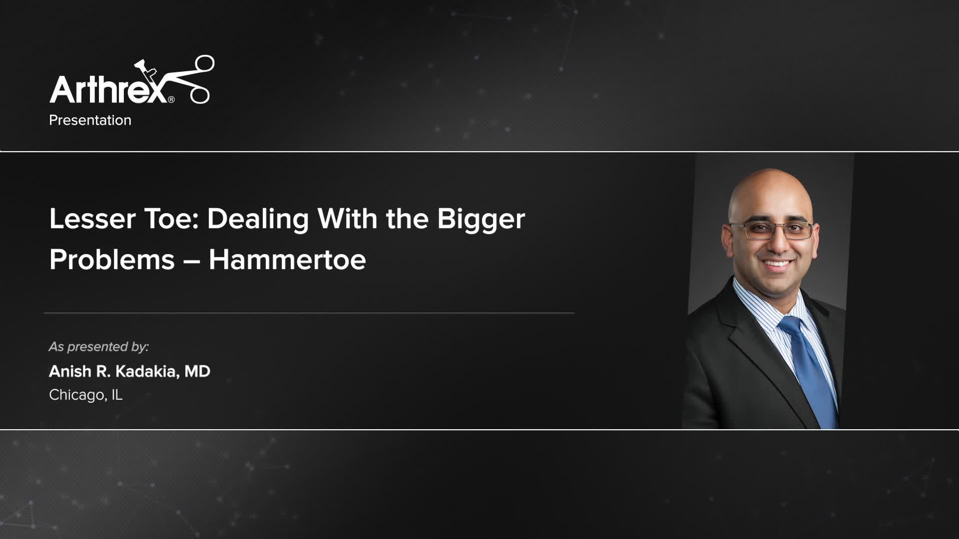 Arthrex - Lesser Toe: Dealing With the Bigger Problems - Hammertoe