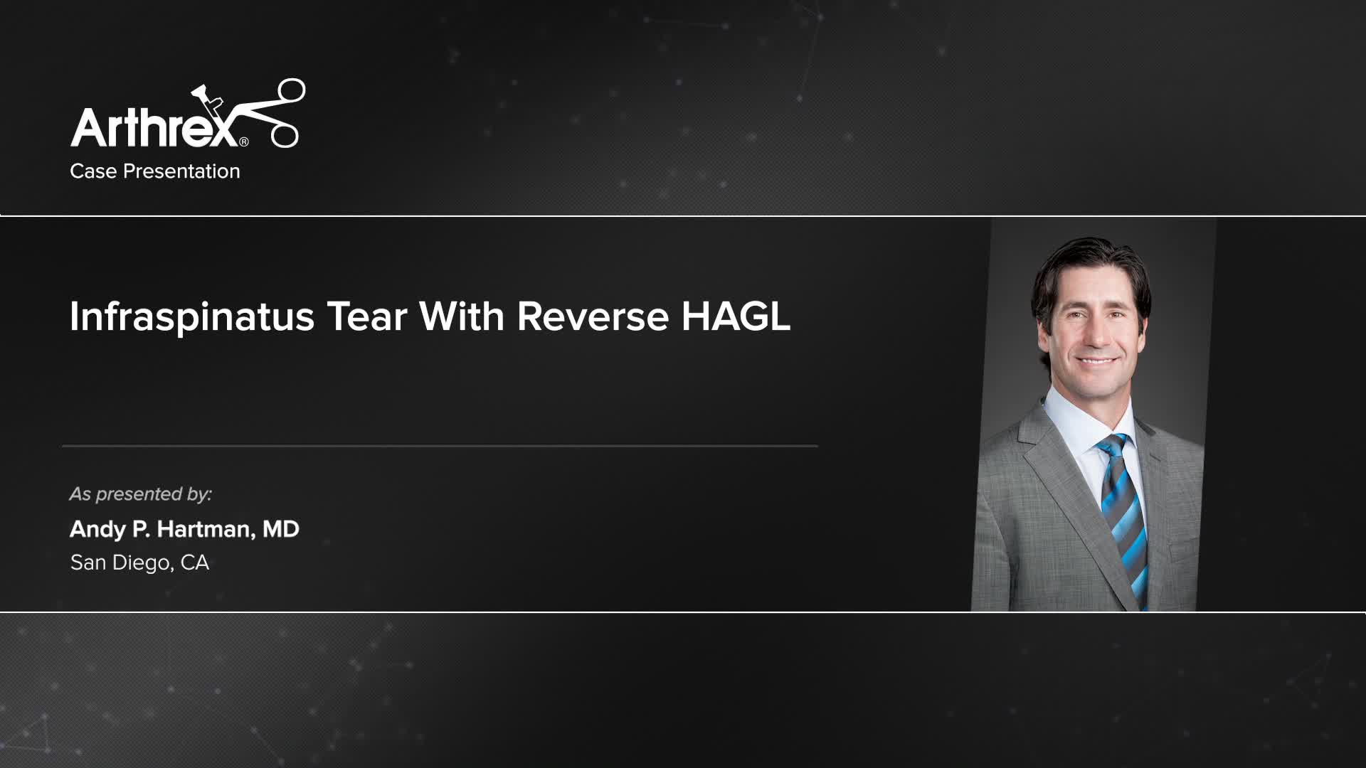 Arthrex - Infraspinatus Tear With Reverse HAGL