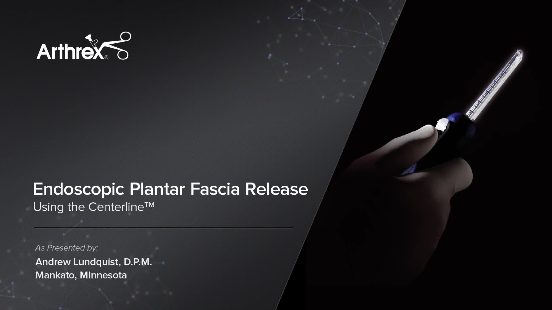 Arthrex - Endoscopic Plantar Fascia Release Using the Centerline™