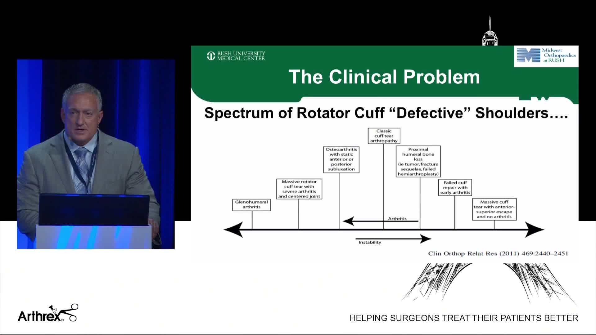 Arthrex - Arthrex Univers Revers™ Shoulder Arthroplasty