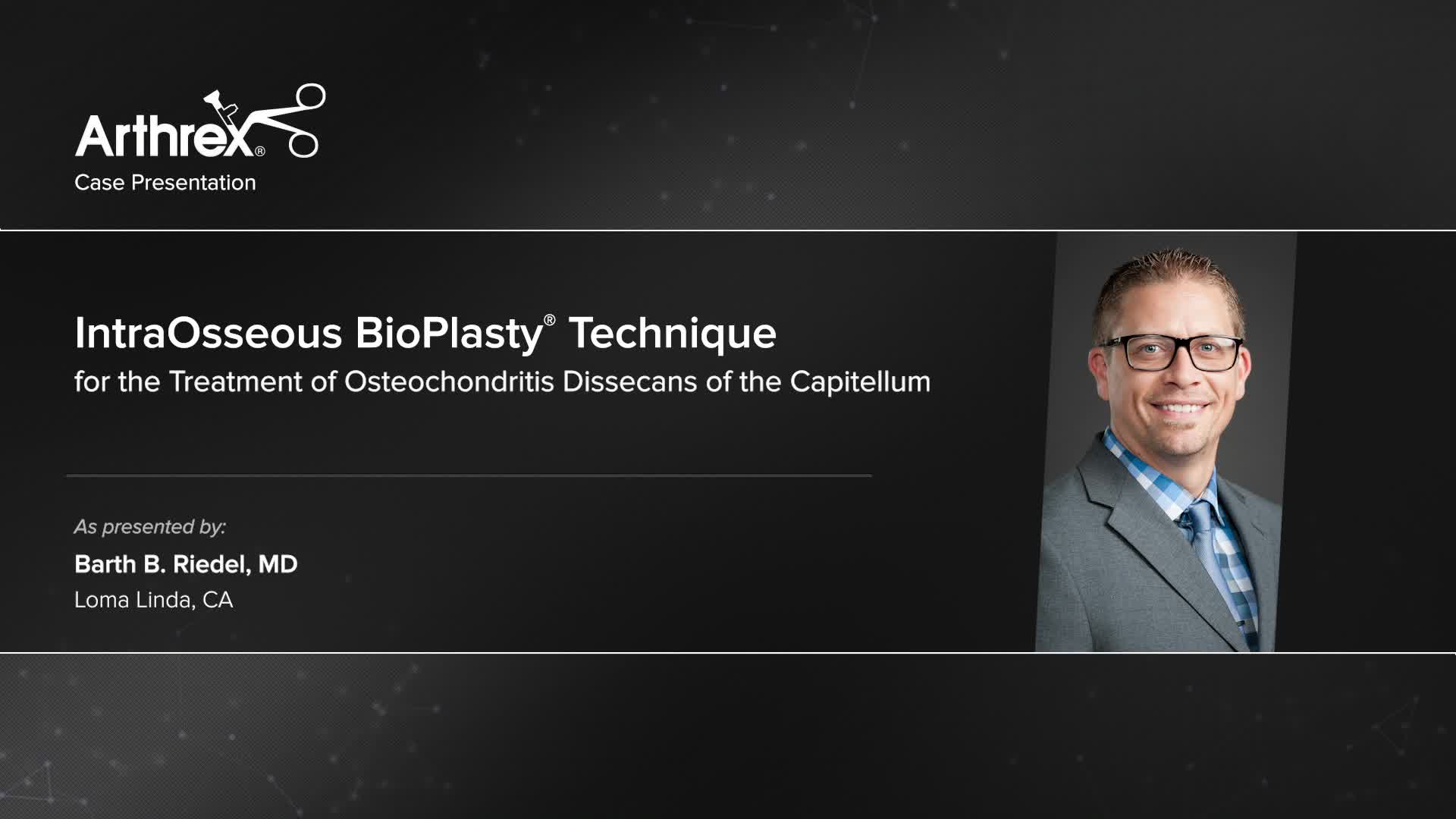 Arthrex - IntraOsseous BioPlasty® Technique for the Treatment of ...