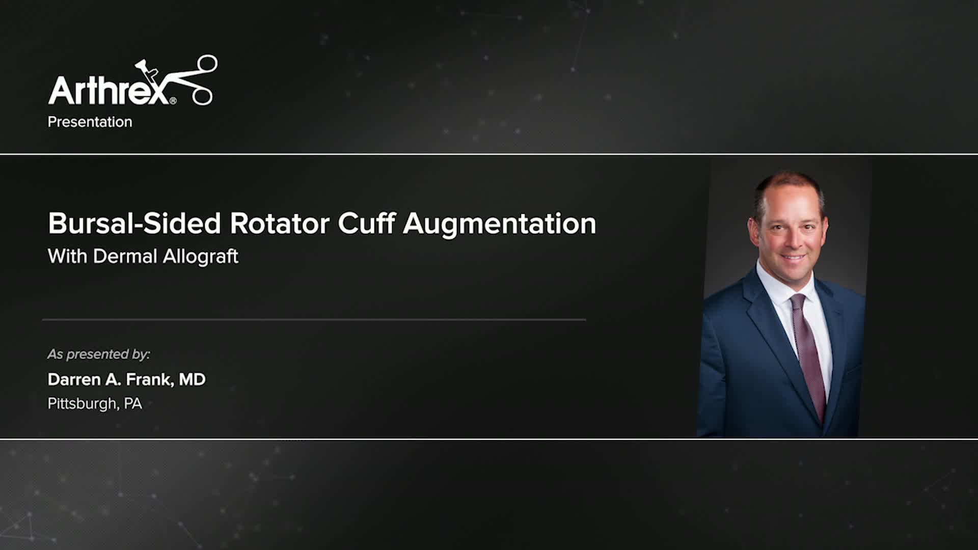 Arthrex - Bursal-Sided Rotator Cuff Augmentation With Dermal Allograft